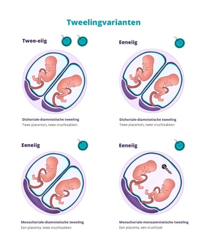 Tweeling èèn vruchtzak | 1 | 24baby Forum