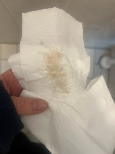 Bruine afscheiding, stress en miskraam gehad | 1 | 24baby Forum