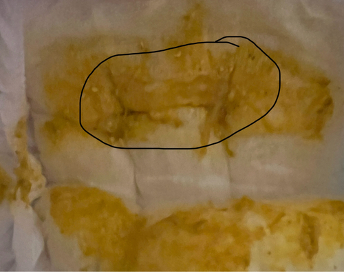 Slijm in ontlasting (let op met foto!) | 1 | 24baby Forum