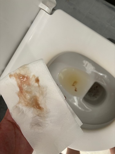 Slijmprop na strippen? FOTO | 1 | 24baby Forum