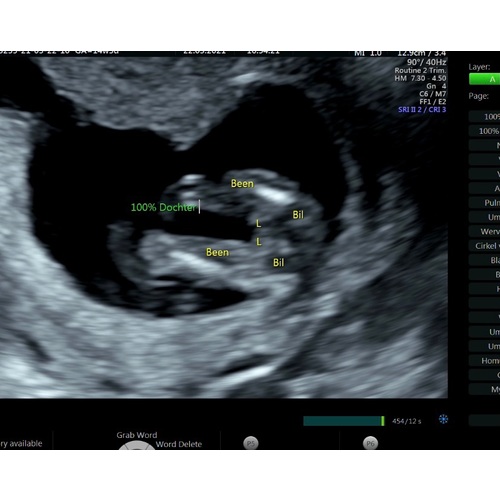 Beetje teleurgesteld uitslag geslachtsbepaling | 1 | 24baby Forum