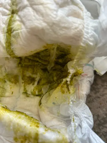 Groene ontlasting (let op met foto!!!) | 1 | 24baby Forum