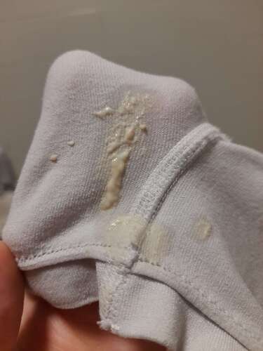 Afscheiding ( Let op Foto!!) | afscheiding | 1 | 24baby Forum