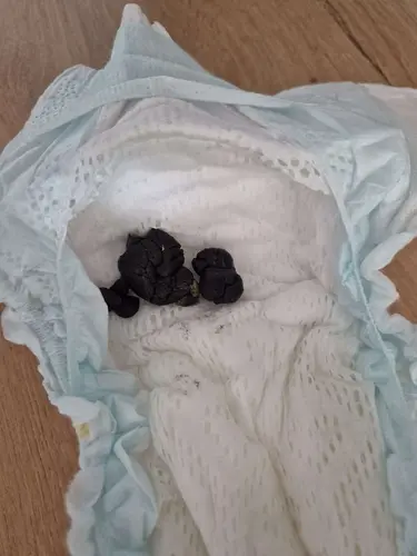 LET OP! POEPFOTO zwarte poep | 1 | 24baby Forum