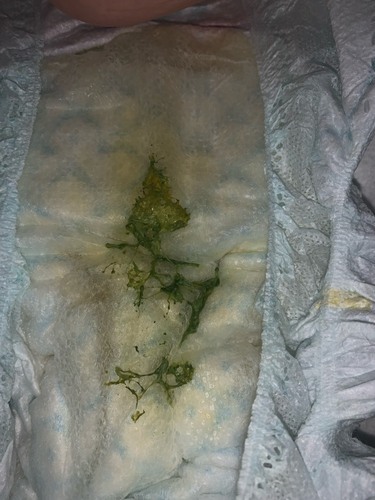 Groene ontlasting baby (met foto) | 1 | 24baby Forum