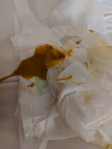 Ontlasting baby borstvoeding (foto) | 1 | 24baby Forum