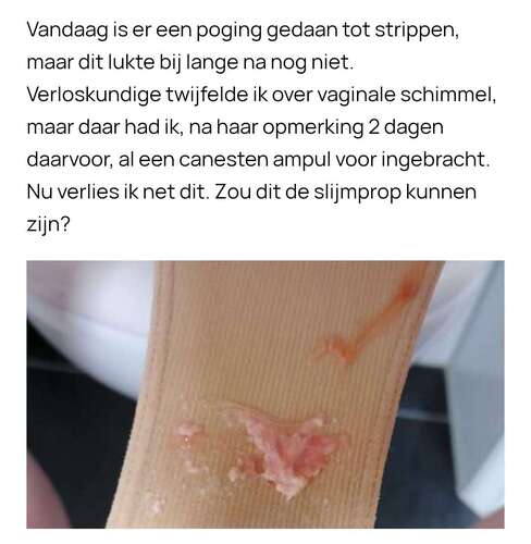 Slijmprop? (let op, FOTO!!) | bevalling | 1 | 24baby Forum