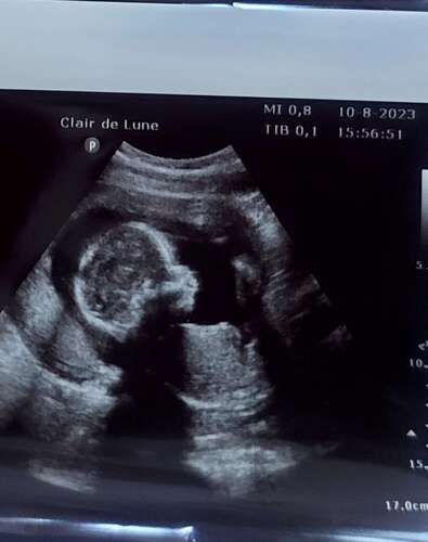 Wonder verhaaltje na een miskraam👣 ️🦋 | 1 | 24baby Forum