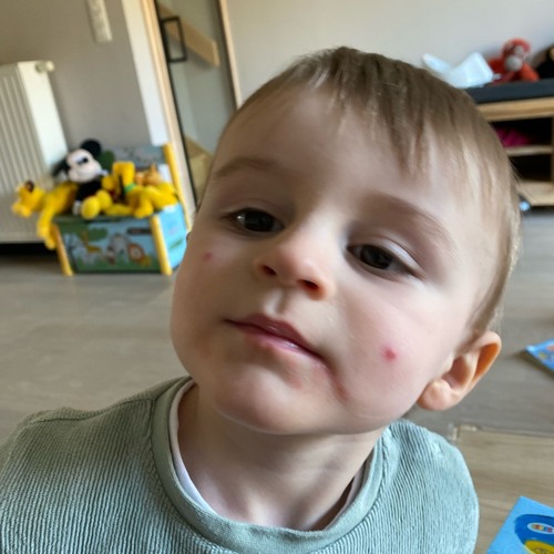 2 rare ‘zweertjes’ op gezicht, foto | 1 | 24baby Forum