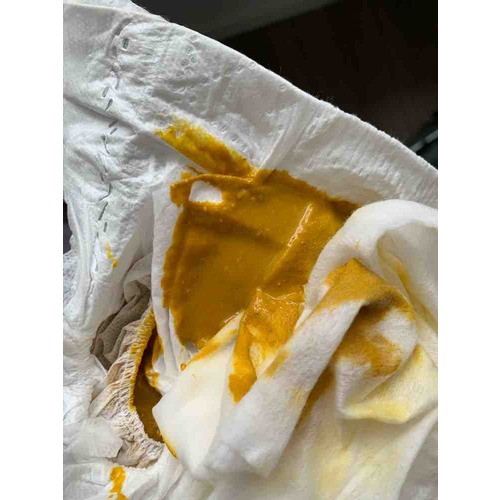 Ontlasting flesvoeding (foto!:)) | 1 | 24baby Forum