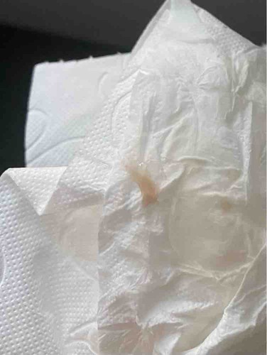 Innestelingsbloeding (FOTO 🩸) | 1 | 24baby Forum