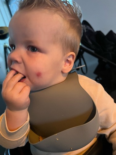 Muggenbult | 1 | 24baby Forum