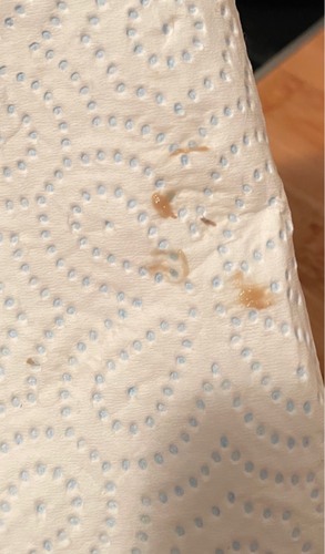 Bruine “snotjes” afscheiding | afscheiding | 1 | 24baby Forum