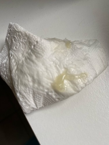 Slijmprop ? (Foto) | bevalling | 1 | 24baby Forum