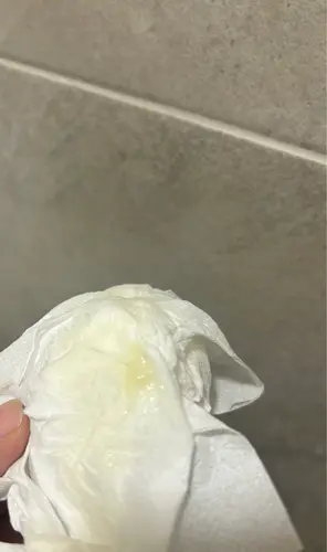 Slijmprop? FOTO! | 1 | 24baby Forum