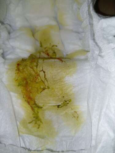 Groene ontlasting incl rood. Pas op foto!! | 1 | 24baby Forum
