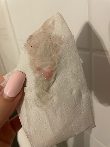 FOTO!!! Innestelingsbloeding? Wanneer testen? | 1 | 24baby Forum