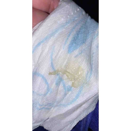 FOTO!!!!! Is dit een deel van slijmprop? | 1 | 24baby Forum
