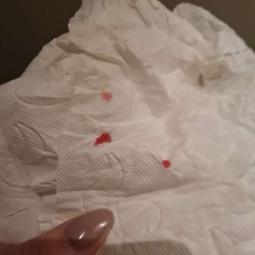 7-8 DPO innesteling bloeding? Pas op foto | 1 | 24baby Forum