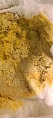 Baby poep rare kleur (foto) | 1 | 24baby Forum