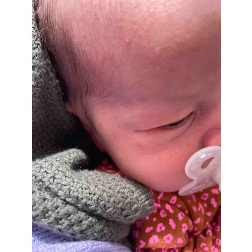 Weet iemand wat voor plekjes dit zijn? | 1 | 24baby Forum