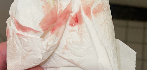 Innesteling? | 1 | 24baby Forum