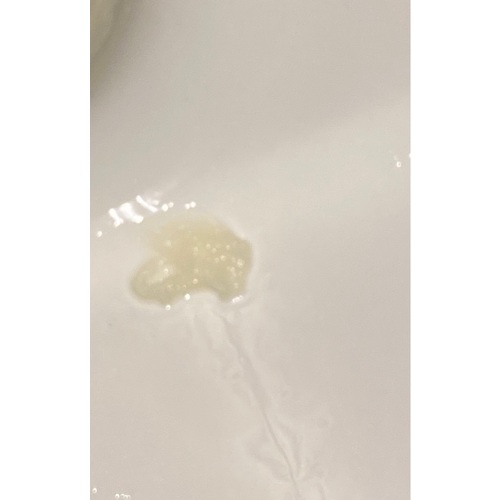 Is dit DE slijmprop? LET OP FOTO | bevalling | 1 | 24baby Forum