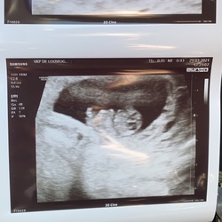 💧 Veel witte afscheiding/witverlies | 1 | 24baby Forum